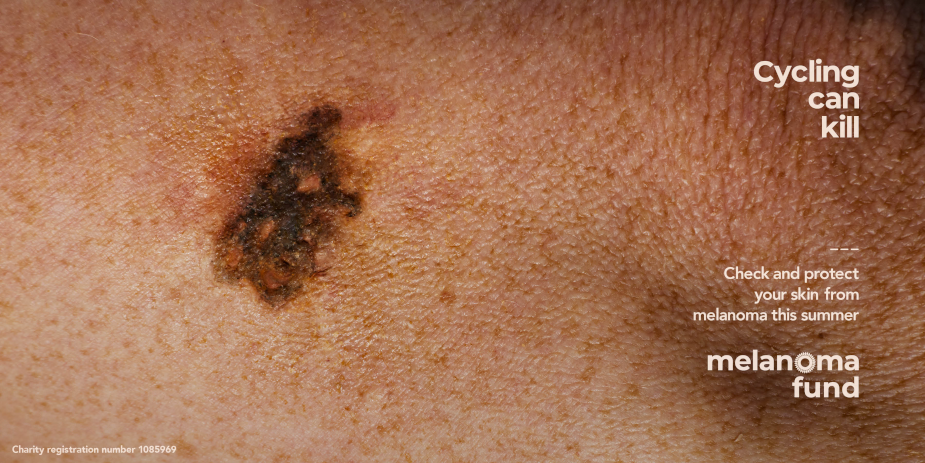 Melanoma Fund’s “Silhouettes” shines a light on the need for sun ...
